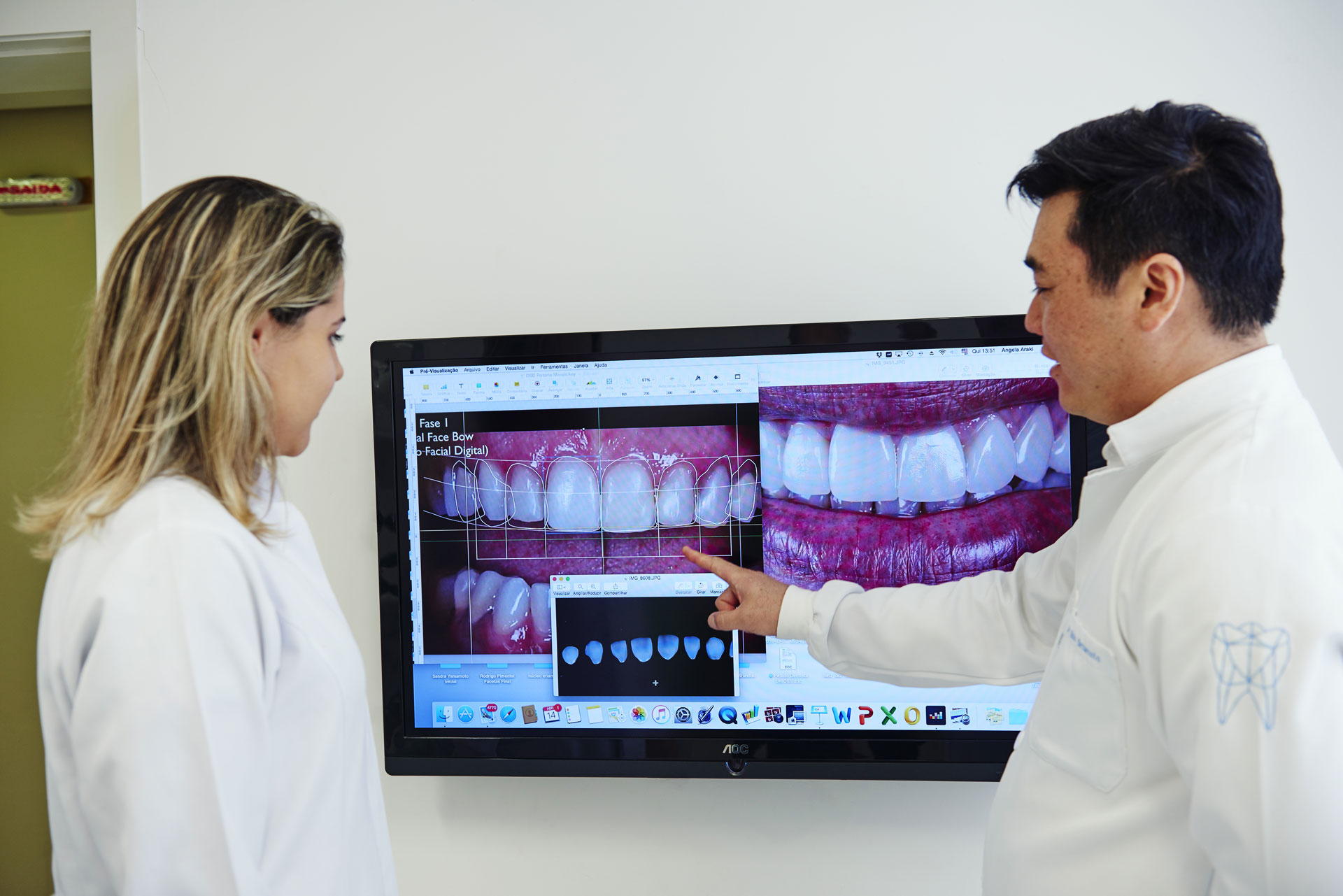 DSD - Digital Smile Design - Lira Odonto